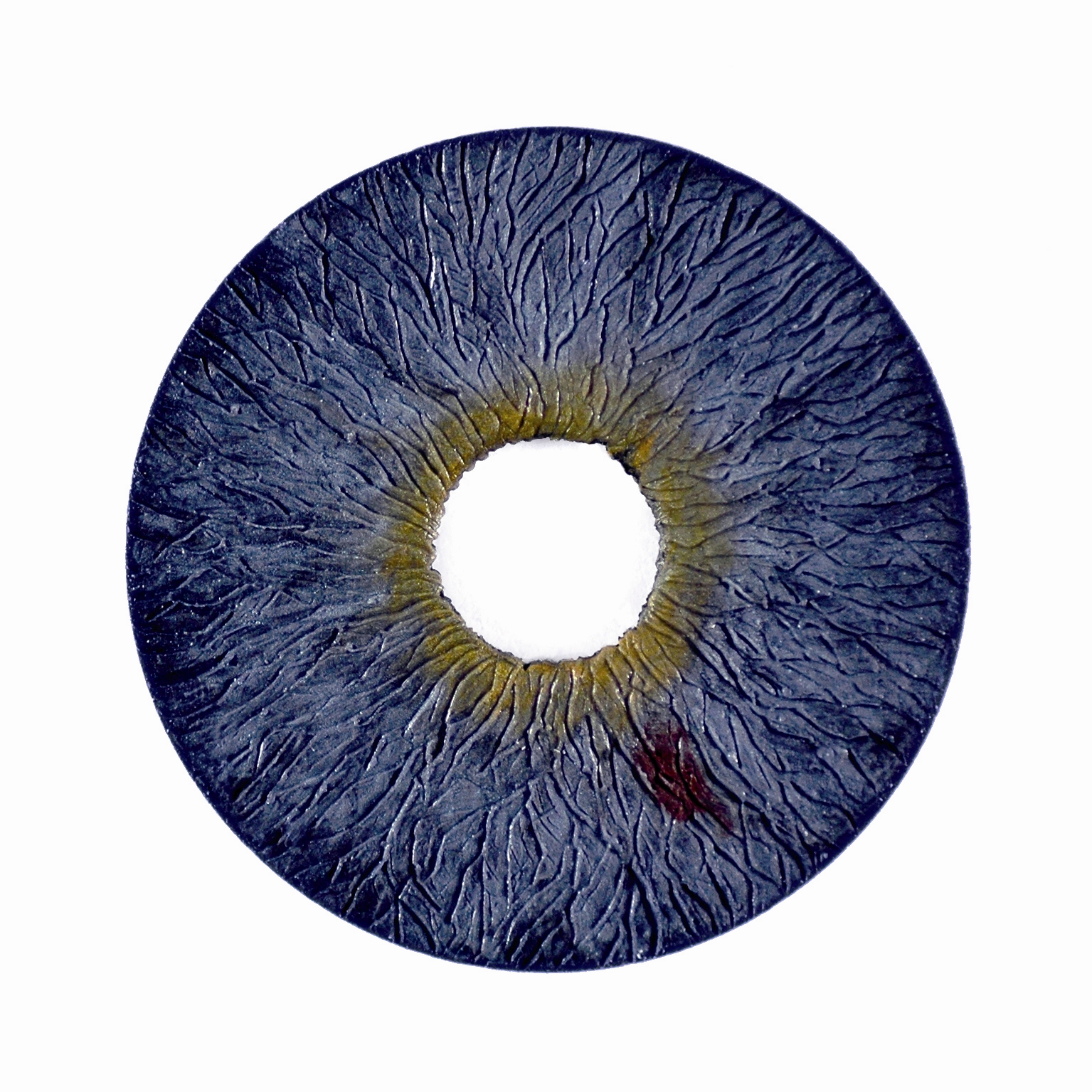 HumanOptics ARTIFICIAL IRIS | Mediconsult Österreich